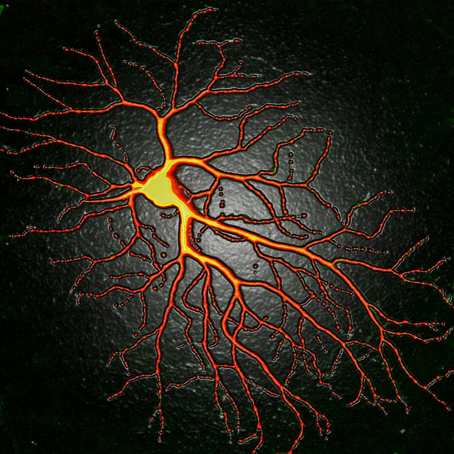 Nerve Cell #5 by Science Photo Library