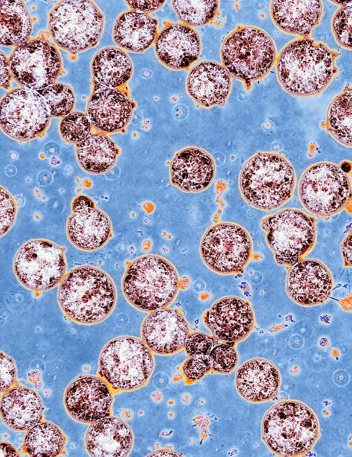 Stem Cells, Light Micrograph #5 by Science Photo Library