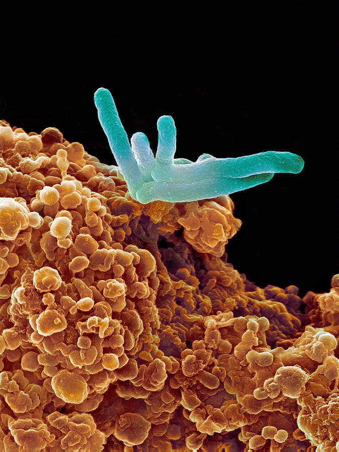 Bacteria Infecting A Macrophage, Sem Photograph by - Fine Art America