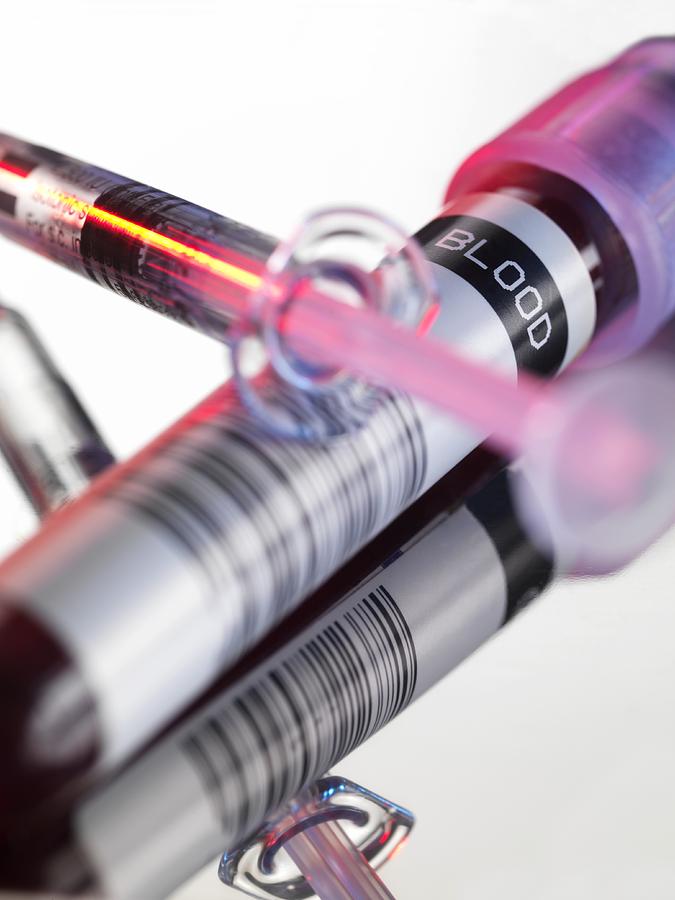 Blood Sample Photograph by Tek Image - Fine Art America