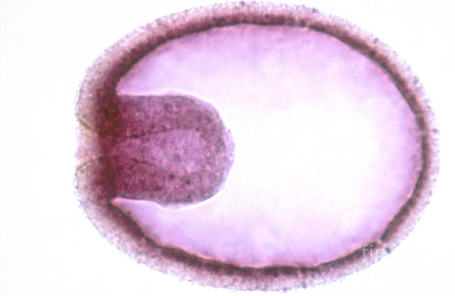 Starfish Embryo Photograph by Science Source - Fine Art America