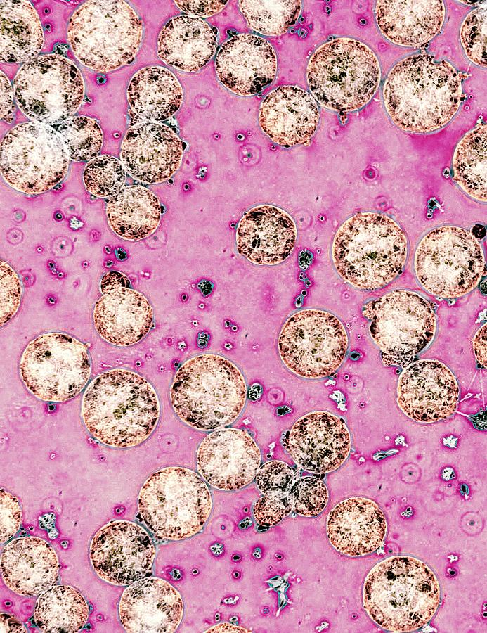 Stem Cells, Light Micrograph Photograph by Nibsc - Fine Art America