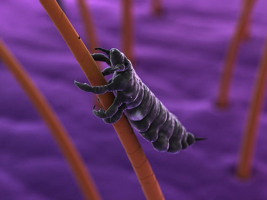 Head Louse, Artwork #7 by Science Photo Library