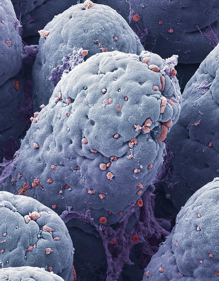 Intestinal Lining, Sem Photograph by Steve Gschmeissner - Pixels