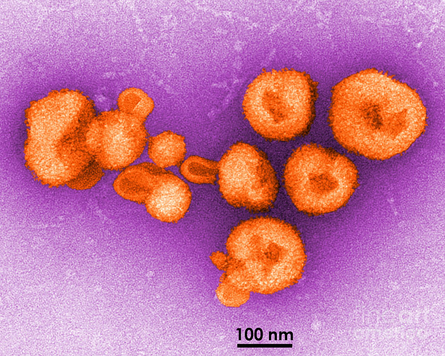 Arenavirus, Tem Photograph by Science Source - Fine Art America