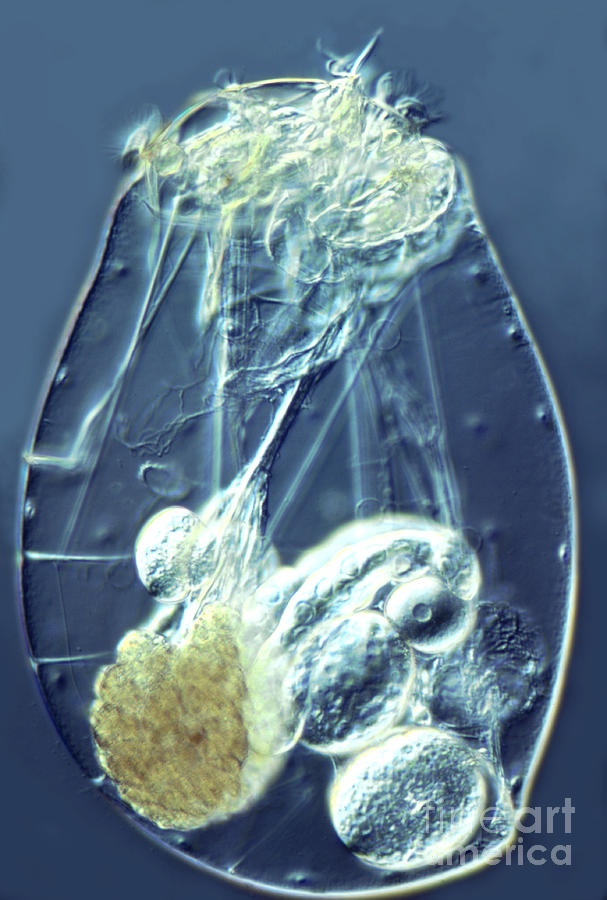 Asplanchna Photograph by M. I. Walker - Fine Art America
