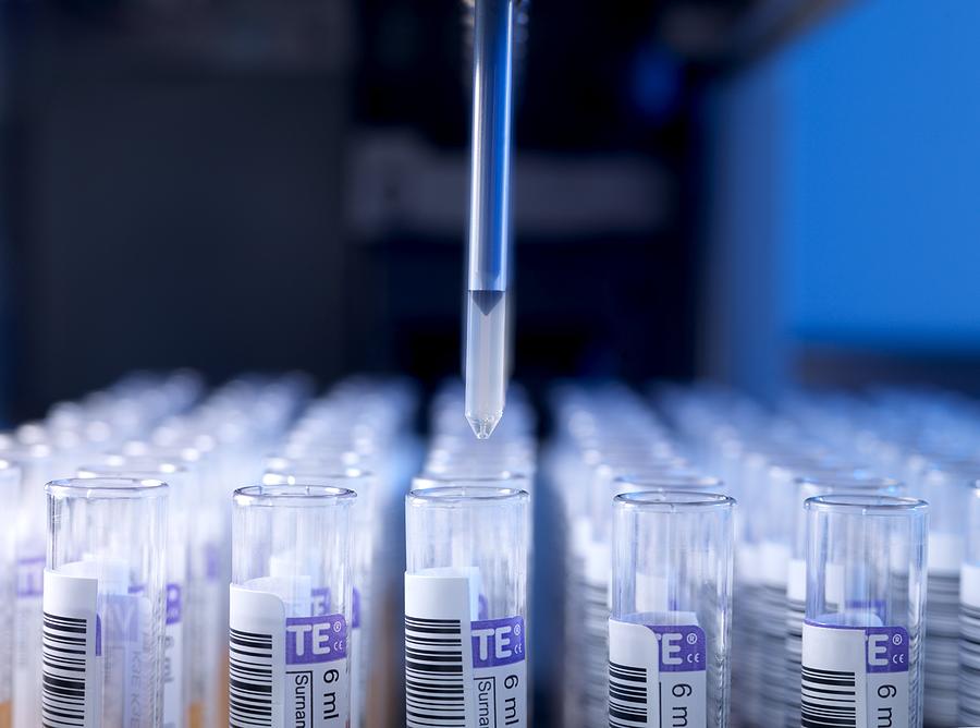 Automated Blood Sample Testing Photograph by Tek Image - Fine Art America