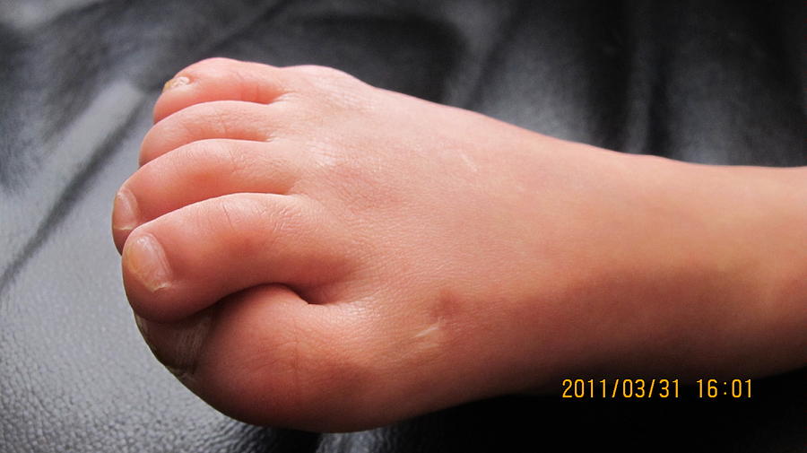 Big Toe Photograph by Tina M Wenger - Fine Art America