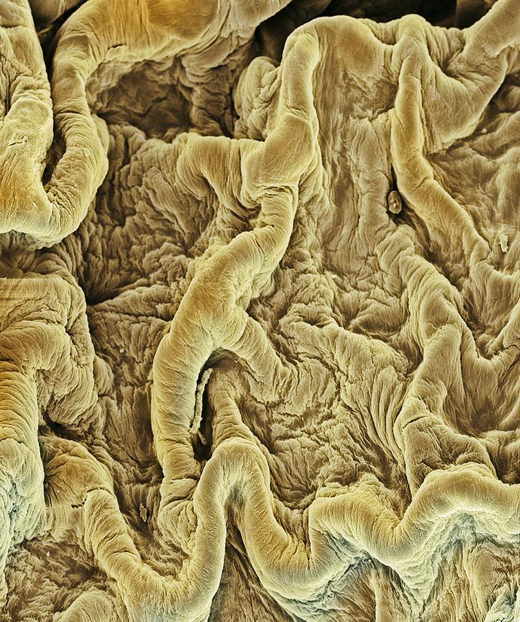 Bladder Lining, Sem by Science Photo Library