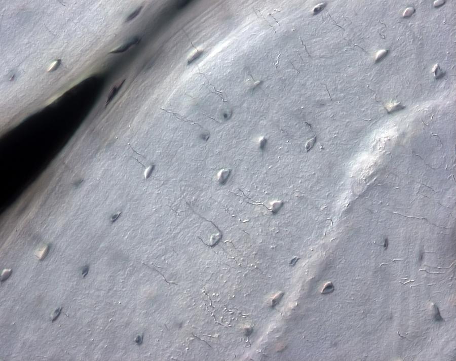 Bone Tissue, Light Micrograph Photograph by Robert Markus - Fine Art ...