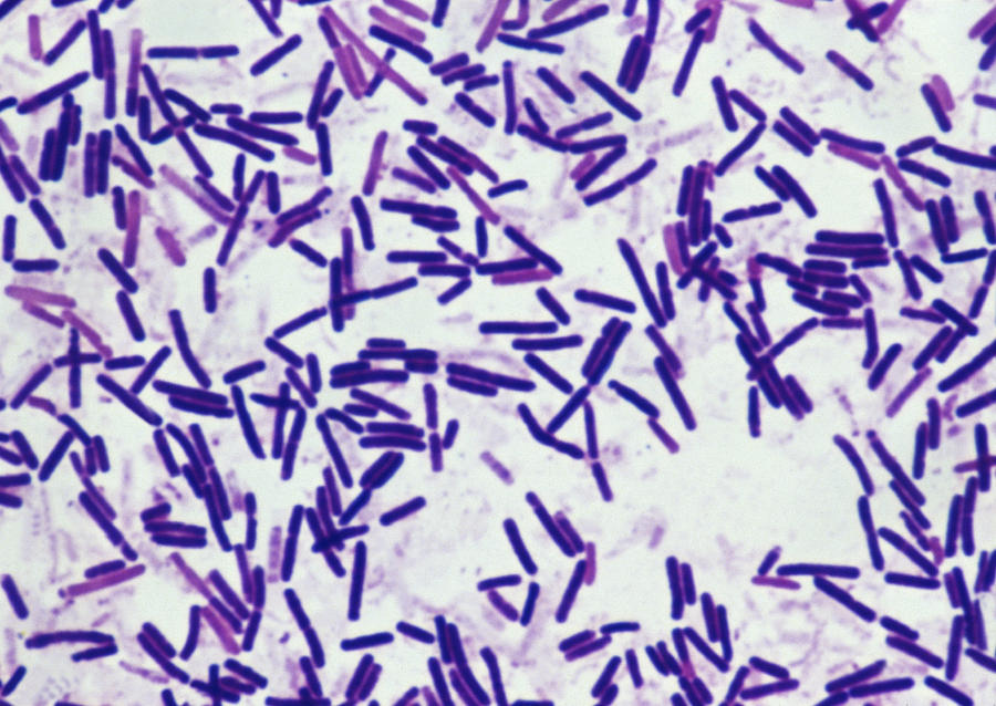 Botulism Bacteria by Science Photo Library