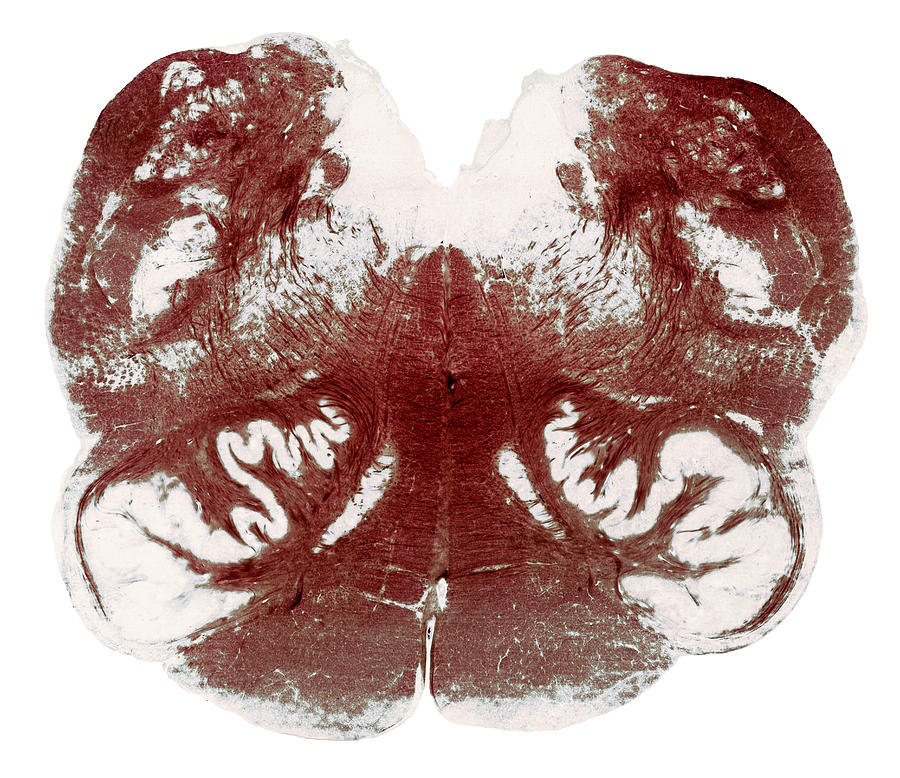 Brain Stem Cross Section