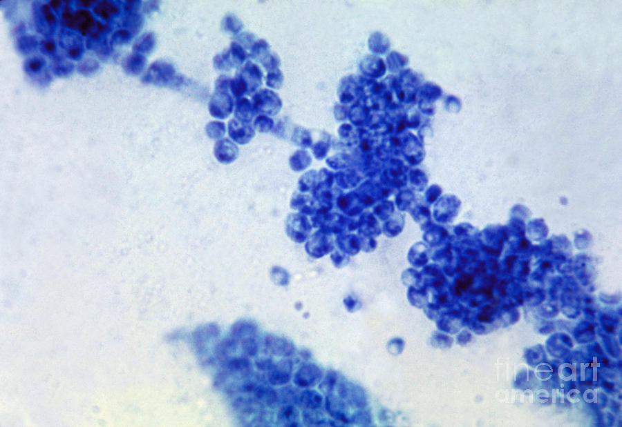 Candida Albicans, Lm Photograph by Science Source - Pixels