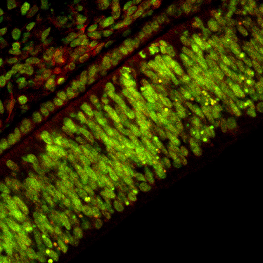 Cell Death Photograph by David Becker - Fine Art America