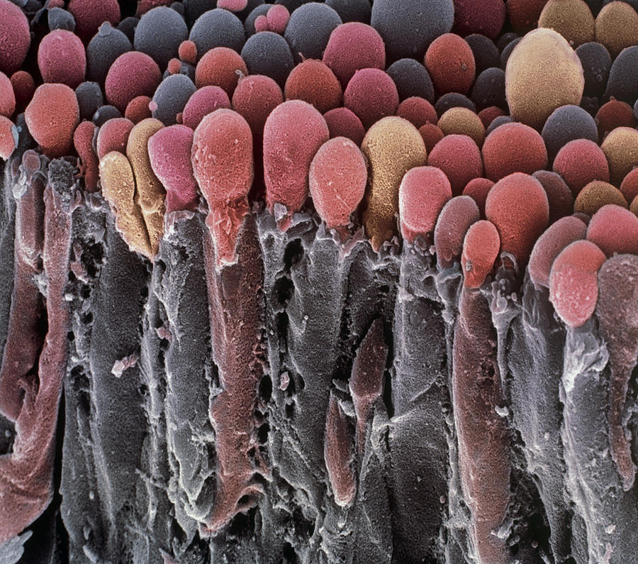 Choroid Plexus Secretory Cells, Sem Photograph by Steve Gschmeissner ...