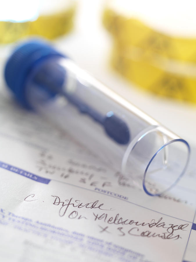 Clostridium Difficile Test by Science Photo Library