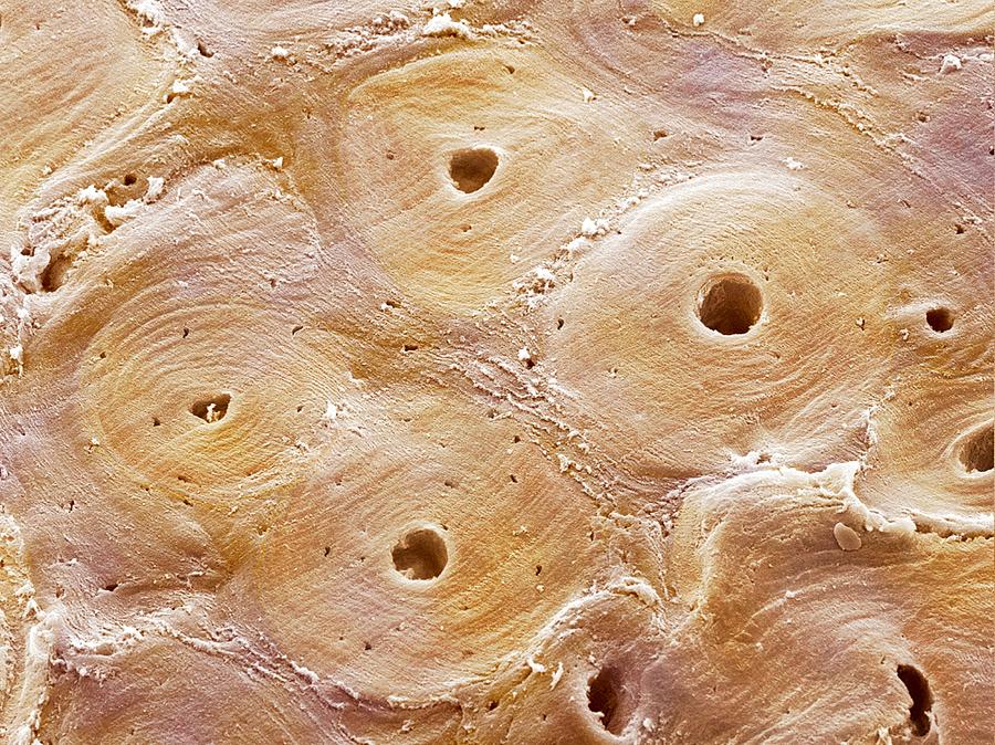 Compact Bone by Power And Syred / Science Photo Library