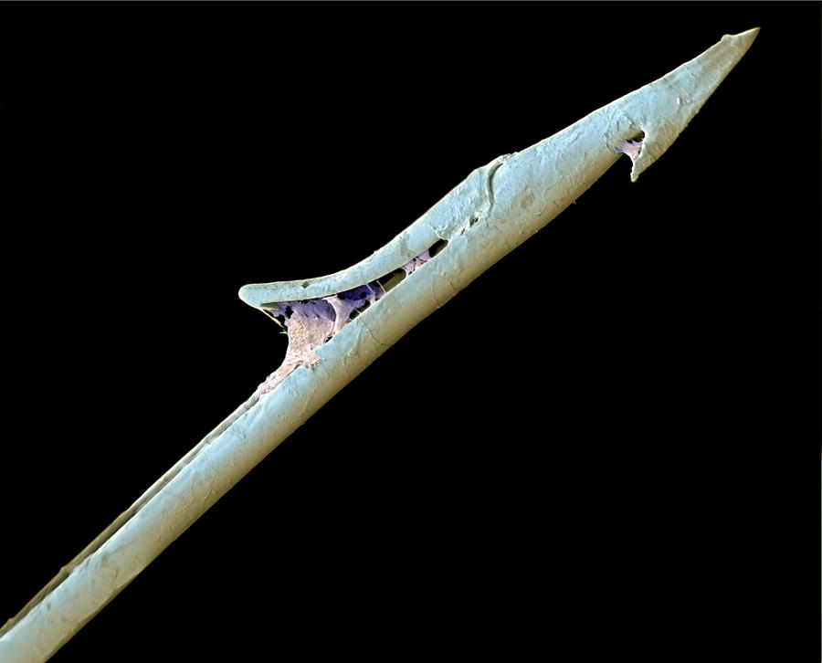 Cone Shell Harpoon, Sem by Volker Steger / Science Photo Library