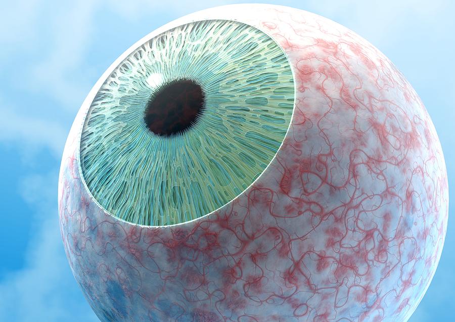 Conjunctivitis, Conceptual Artwork by Science Photo Library