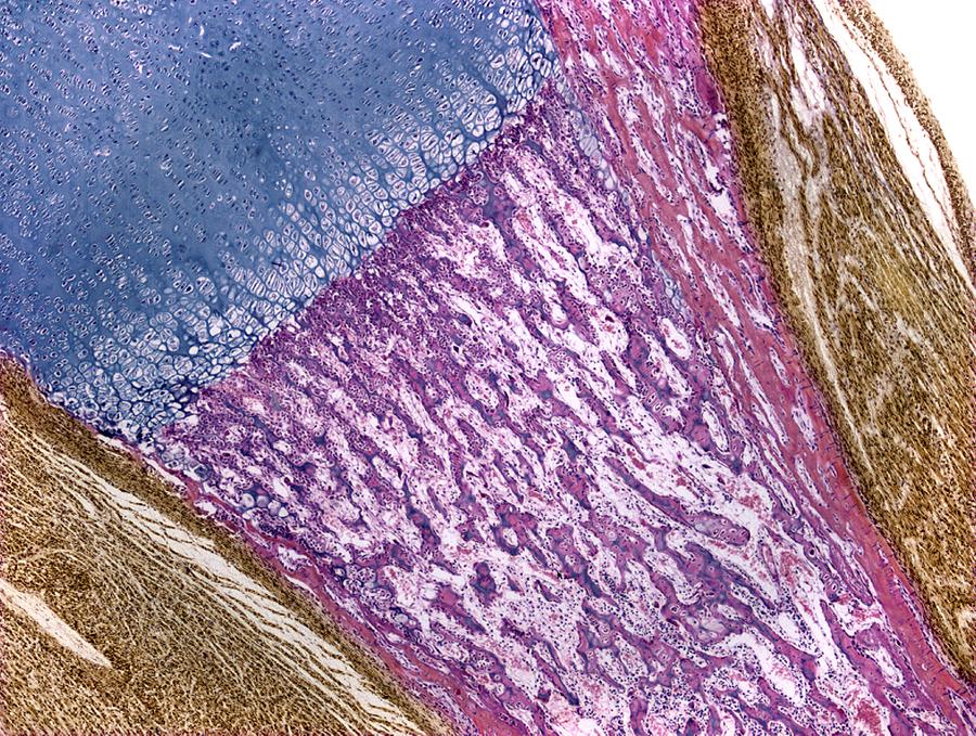 Developing Bone, Light Micrograph by Steve Gschmeissner / Science Photo ...