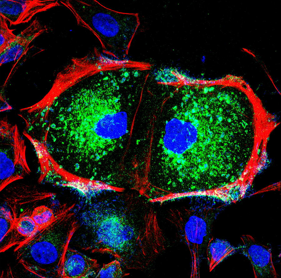 Dividing Cell, Light Micrograph Photograph by - Pixels