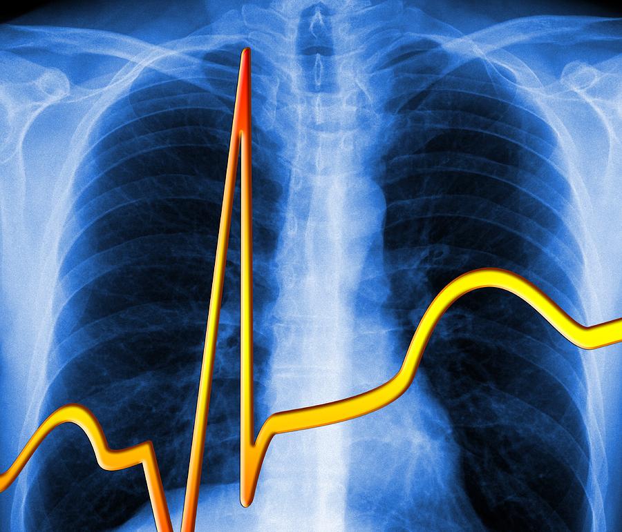 Ecg Trace by Science Photo Library