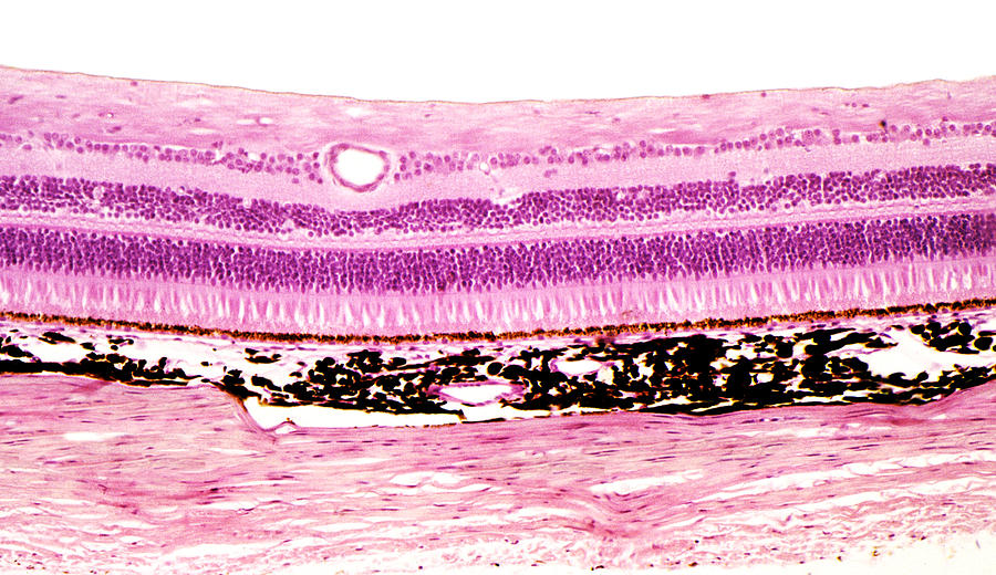 Eye Structure, Light Micrograph Photograph by Steve Gschmeissner | Pixels