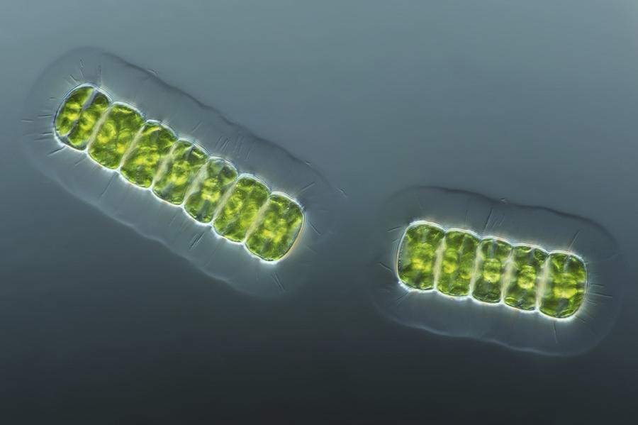Green Algae, Light Micrograph Photograph by Frank Fox - Pixels