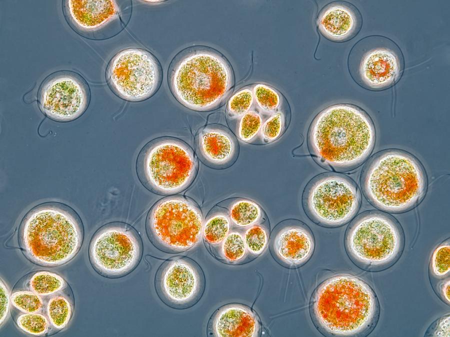 Green Algae, Light Micrograph by Gerd Guenther / Science Photo Library