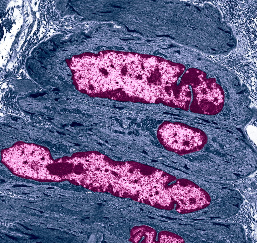 Gut Muscle Cells, Tem Photograph by Steve Gschmeissner - Fine Art America