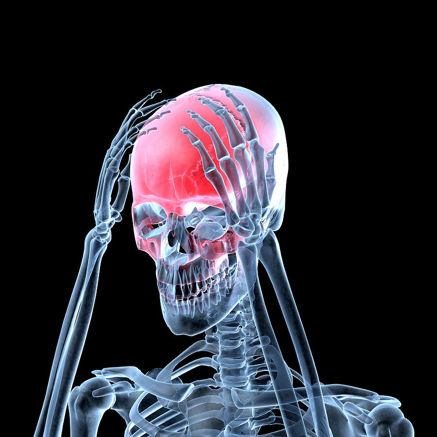 Headache Photograph by David Mack - Fine Art America