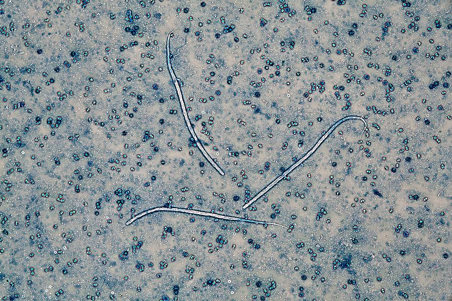 Heartworms, Light Micrograph Photograph by Jerzy Gubernator - Pixels