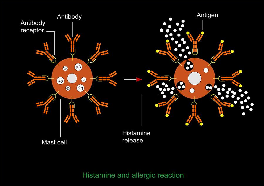 Histamine Allergic Reaction Diagram Photograph By Francis Leroy Biocosmos