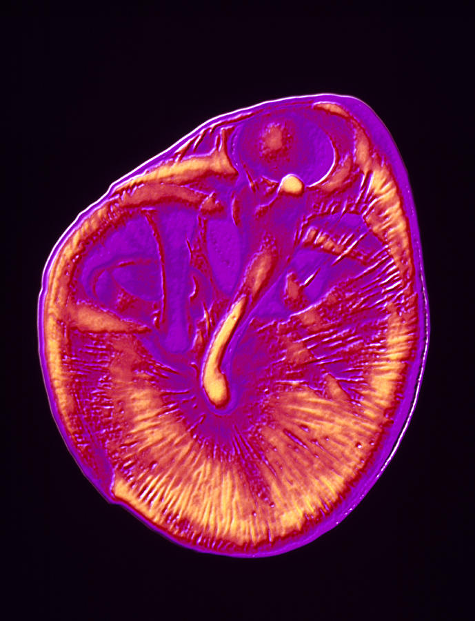 Human Eardrum by Alfred Pasieka / Science Photo Library