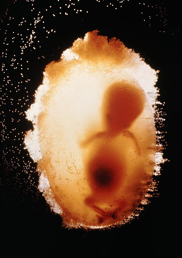 Human Foetus by Science Photo Library