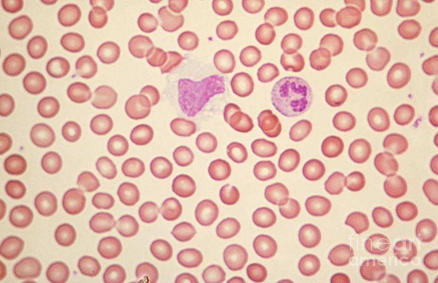 Infectious Mononucleosis Photograph by AFIP/Science Source - Pixels
