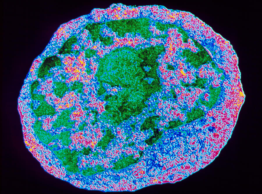 Streptococcus Lactis
