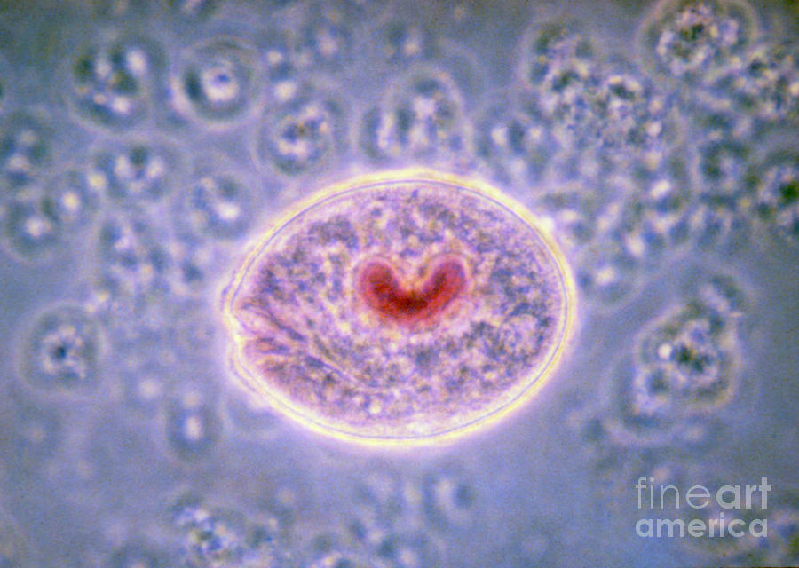 Lm Of Balantidium Coli A Parasitic Photograph By Eric Grave Pixels