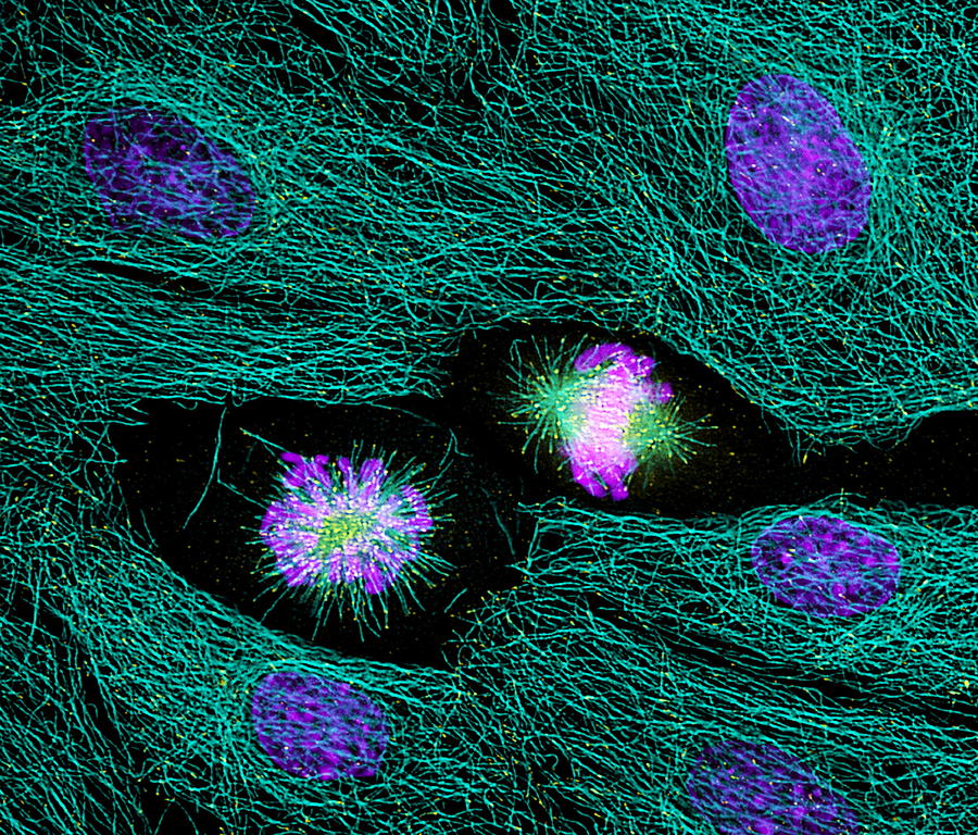Mitosis by Science Photo Library