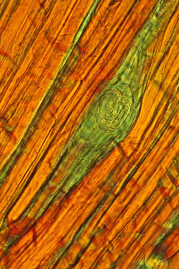 Nematode Larval Cyst Light Micrograph By Science Photo Library