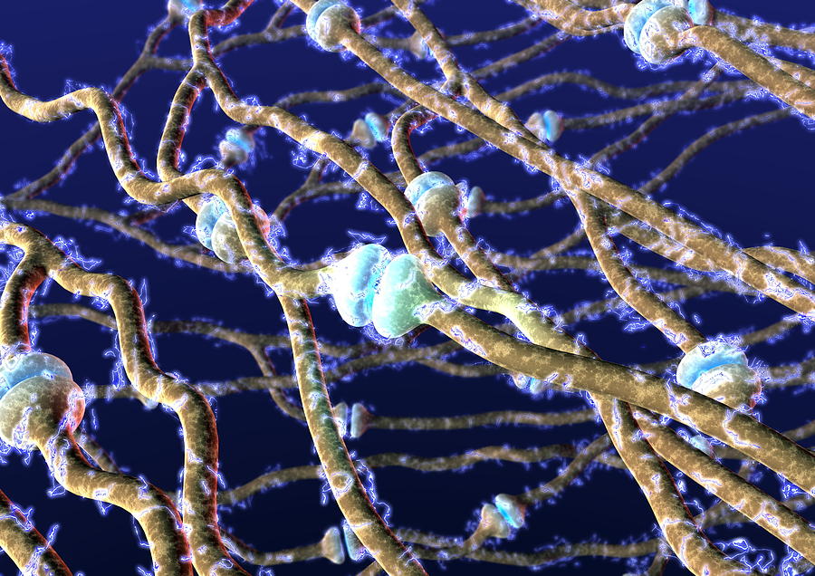 Neural Overload by Science Photo Library