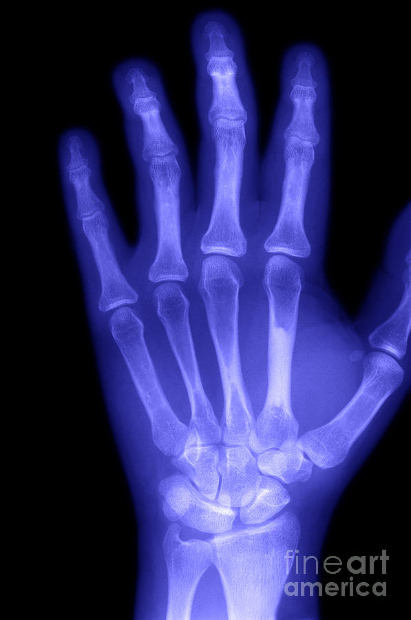 Normal Human Hand Photograph by Ted Kinsman - Fine Art America