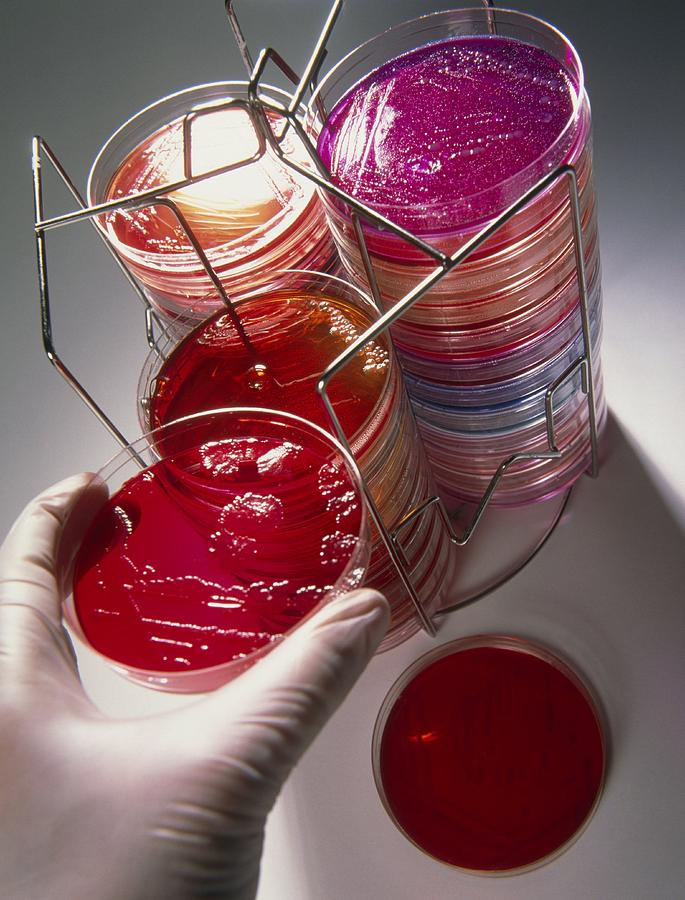 Petri Dish Bacterial Culture Being Placed In Stack Photograph by Tek Image