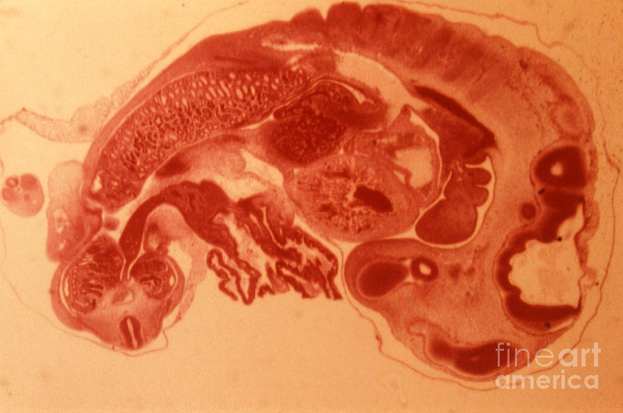Pig Embryo Photograph by Eric V. Grave - Fine Art America