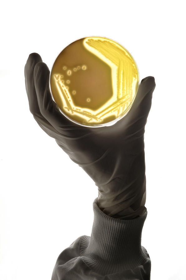 Pseudomonas Culture Photograph by Tim Vernon, Lth Nhs Trust - Pixels