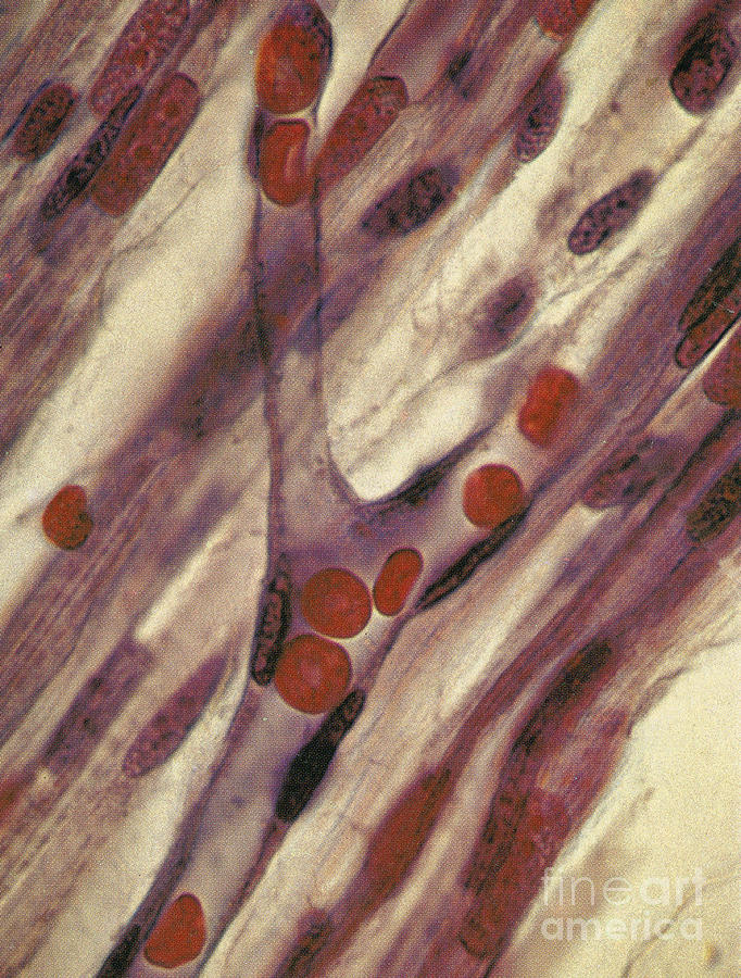 Red Blood Cells Photograph by Science Source - Fine Art America