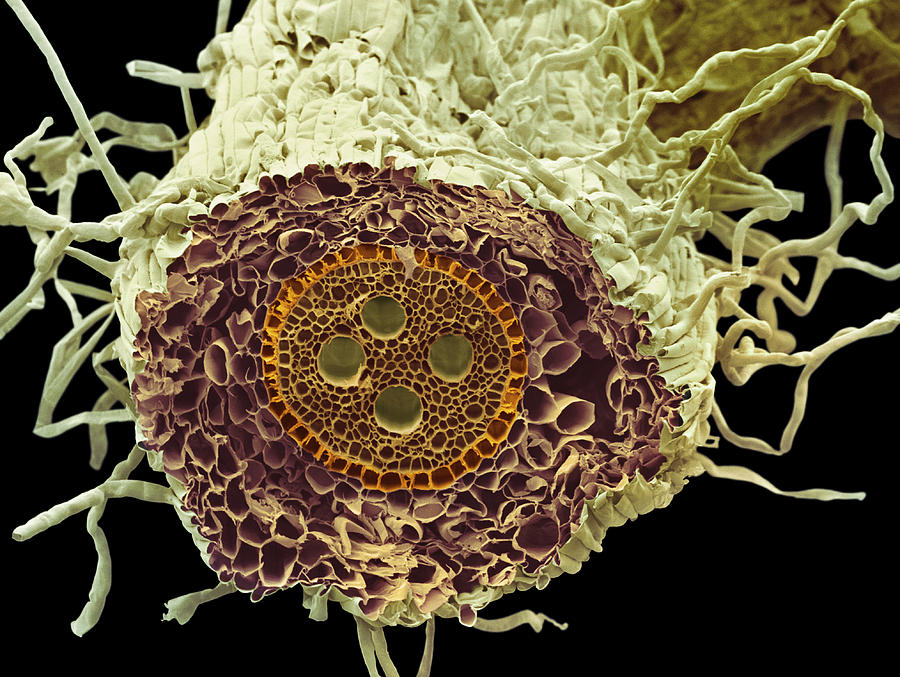 Root Section, Sem Photograph by Steve Gschmeissner