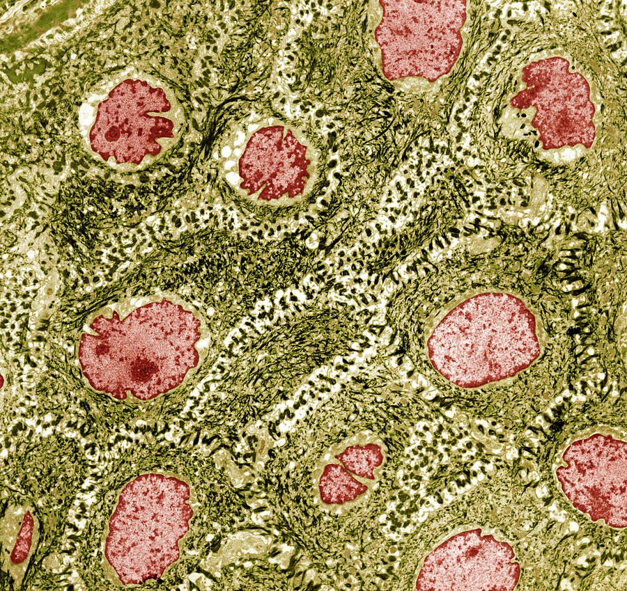 Skin Cells, Tem by Science Photo Library