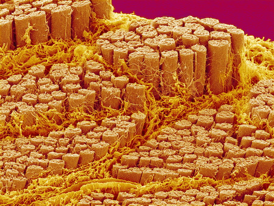 Smooth Muscle, Sem Photograph by Susumu Nishinaga - Pixels Smooth Muscle, Sem Photograph by Susumu Nishinaga - Pixels