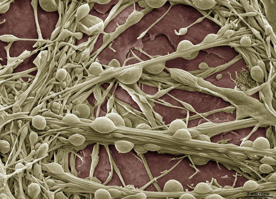 Synapse Nerve Junctions, Sem Photograph by Thomas Deerinck, Ncmir ...